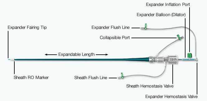 SoloPath™ Re-collapsible - Balloon expandable transfemoral access system